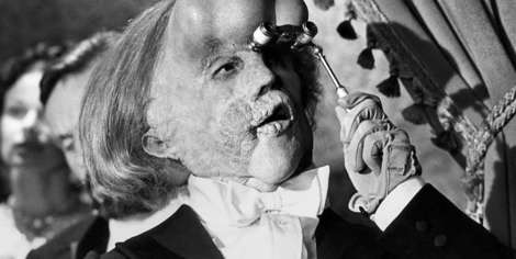 Joseph Merrick: Muž proslulý svou genetickou poruchou dostane nový film ...